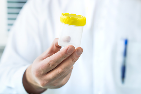 USDOT approves oral fluid drug testing to help combat shy bladder ...